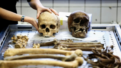 Forensic Anthropology: Identification From Skeletal Remains